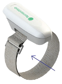 Codo de Tenista - Epicondilitis Lateral - Tendinopatía Lateral del Codo